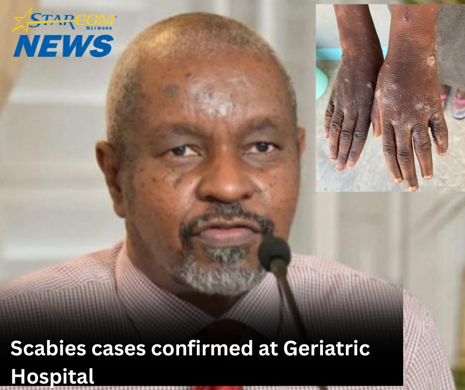 Scabies cases confirmed at Geriatric Hospital - Starcom Network